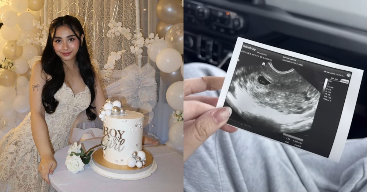 Bea Borres not open to co-parenting with anyone after revealing pregnancy • PhilSTAR Life